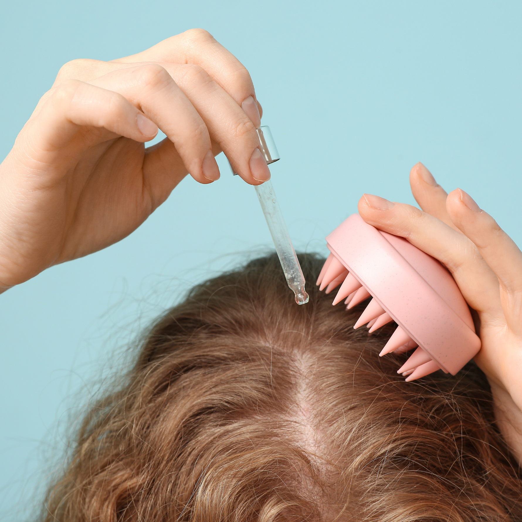 Understanding Scalp Psoriasis: Causes, Symptoms, and Natural Solutions